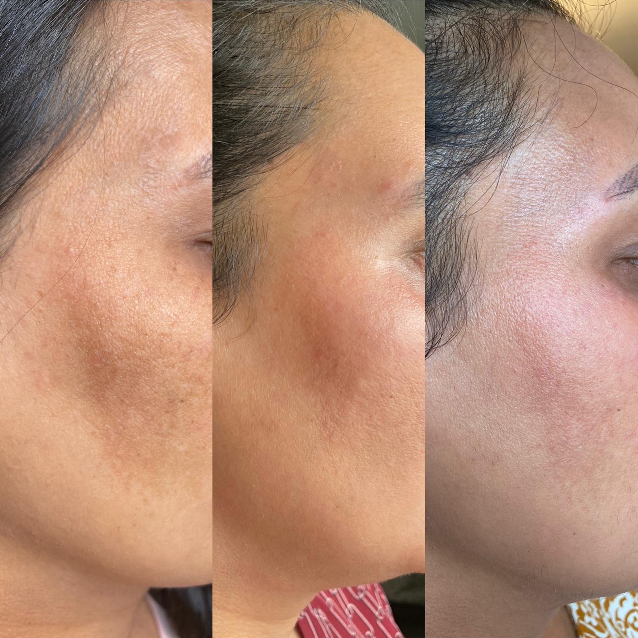 Halifax | Harmony Medical Aesthetics